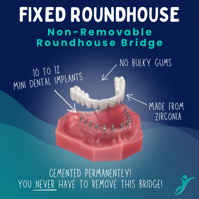 Randy Staples, DDS | Mini Dental Implant Center of Jackson, TN